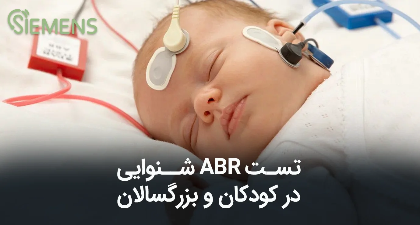 همه چیز درباره تست ABR شنوایی در کودکان و بزرگسالان - کلینیک شنوایی سنجی